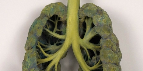 "Judy Fox: Harvest" at the Nancy Hoffman Gallery in New York City: Arts ...